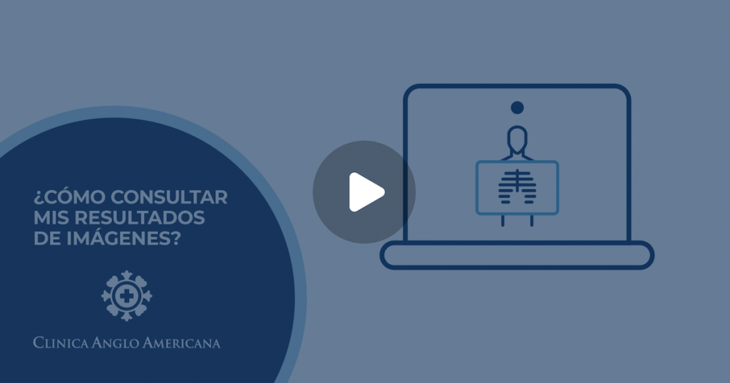 Portal de Imágenes - Clínica Anglo Americana
